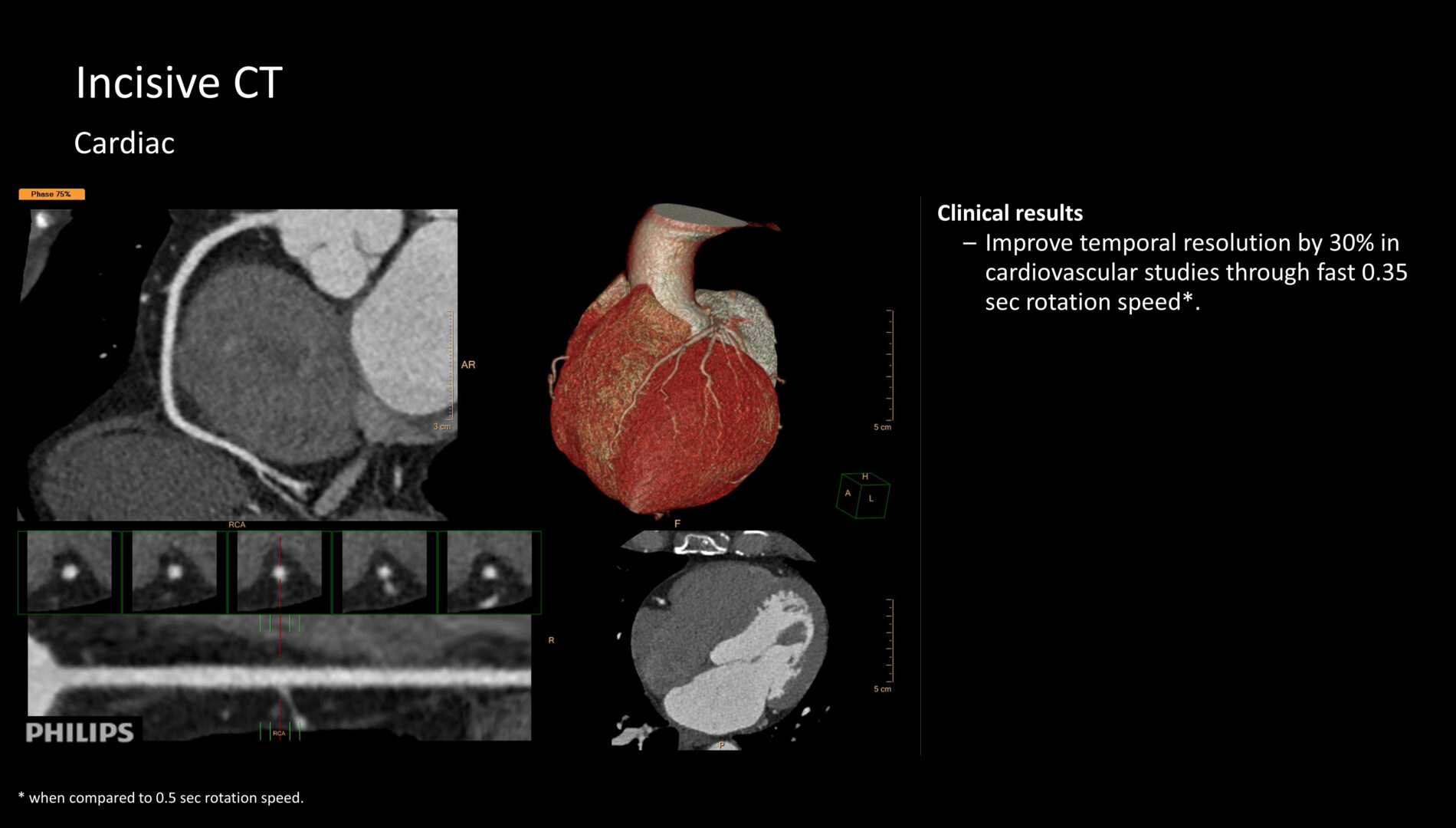 Philips Incisive CT Scan -Taos, New Mexico at Holy Cross Medical Center