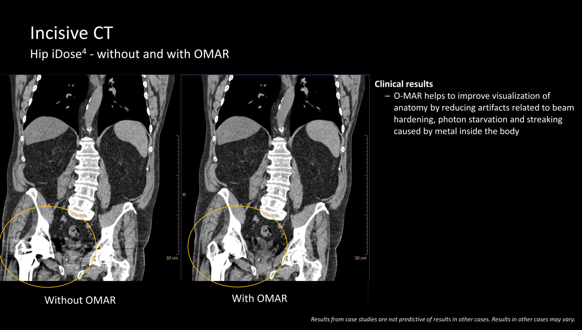Philips Incisive CT Scan -Taos, New Mexico at Holy Cross Medical Center